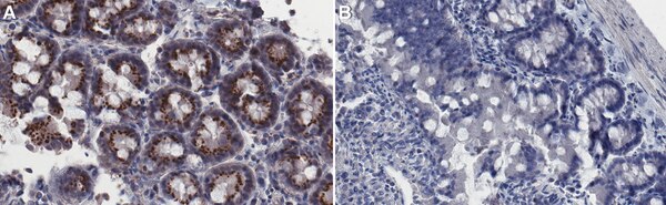 Anti-Apobec1 Antibody | ABE438